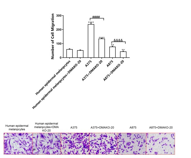 Transwell检测细胞迁移_北京科检易研技术有限公司